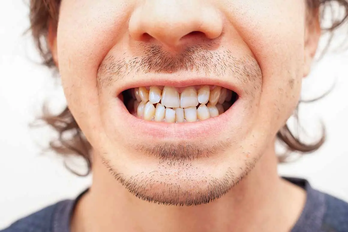 Corrective procedures for crooked teeth - Brunswick Dental Group